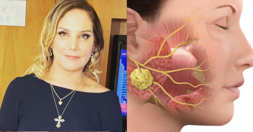 Câncer nas glândulas salivares: Estes são os sintomas do tumor raro que ...