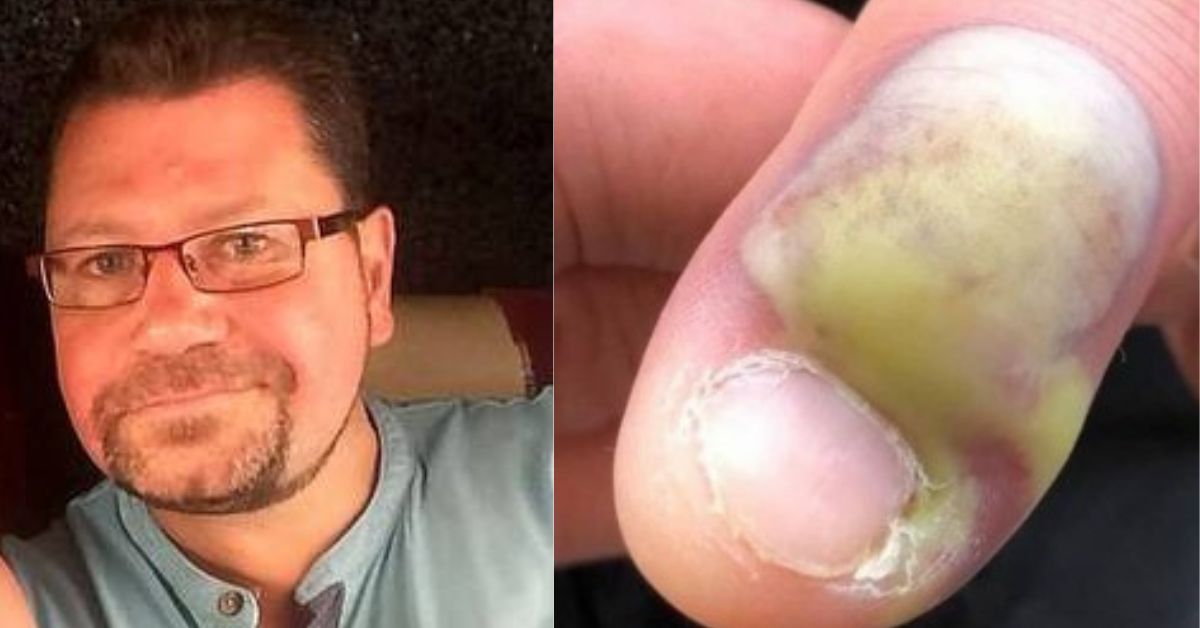 Tem o hábito de roer a unha? Veja o que pode acontecer com você