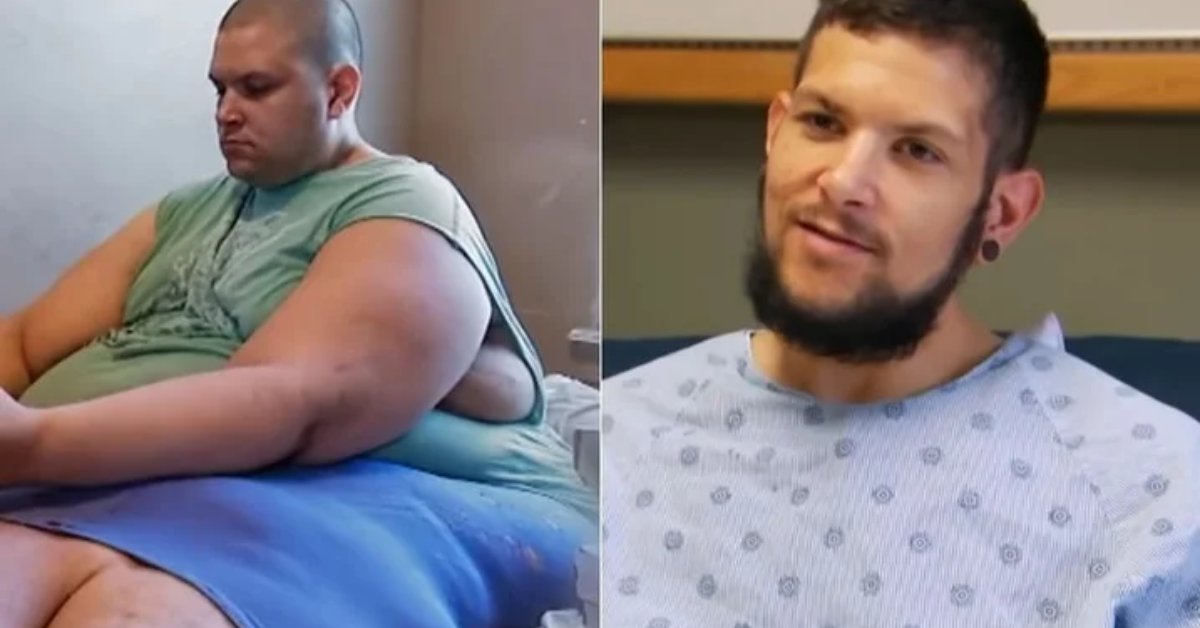 "Quilos Mortais": como está J.T., que tinha mais de 400 kg e convivia com grave problema em sua ...